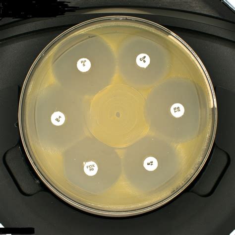 Ast Microbiology Matters