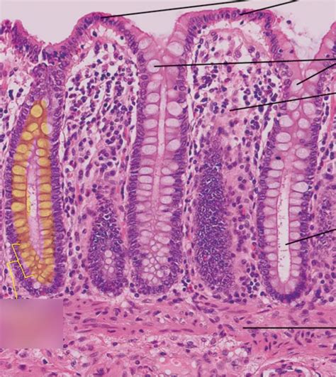 Large Intestine Histology Diagram Quizlet