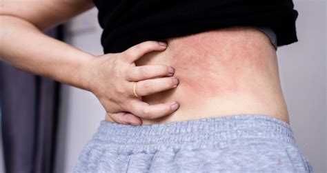 How Is Mcas Diagnosed Take The 3 Minute Test