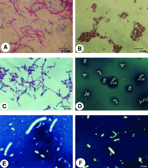 5 Photomicrographs Showing Spore Stain A C And Negative Stain Download Scientific Diagram