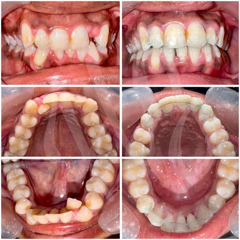 Dr Hari Govind G On Linkedin Class 2 Div2 The Classical Features Of