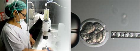 Assisted Hatching Technique At International Fertility Centre