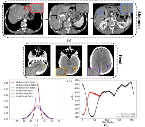Examples Of Head And Abdomen Scans A Abdomen Ldct Scans B Head Download Scientific