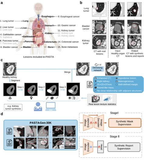 논문 리뷰 A Data Efficient Pan Tumor Foundation Model For Oncology Ct