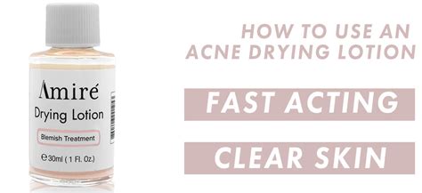 How To Use An Acne Drying Lotion Shopamire