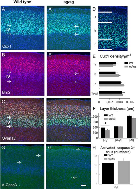 Normal Layering But Decreased Cortical Thickness In P7 Sgsg Mice