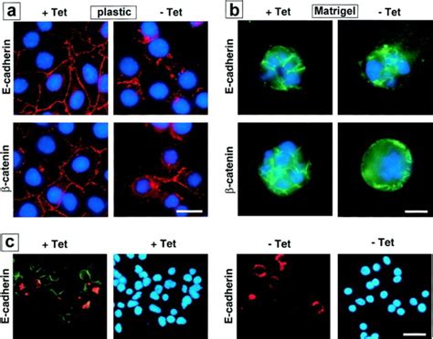 Subcellular Localization Of E Cadherin And β Catenin After Sl 1 Download Scientific Diagram