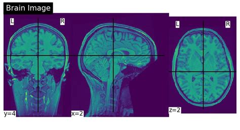 Brain Decoding Using Connectivity Informed Models