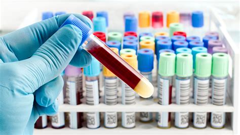 Serological Tests Gluten Free Rn