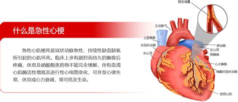 11·20中国心梗救治日时间就是心肌，时间就是生命 徐州仁慈医院胸痛中心