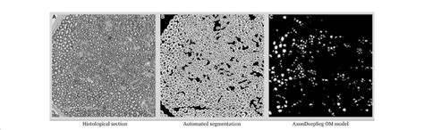 Segmentation Comparison To Axondeepseg Om Model A Histological Download Scientific Diagram