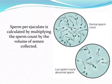 Sperm Countpptx Infertility Reproductive Health