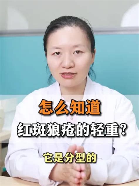 出现这种红斑狼疮，要及早就医 腾讯新闻