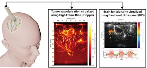 Memristor Implementation Of Compressive Imaging Algorithm For