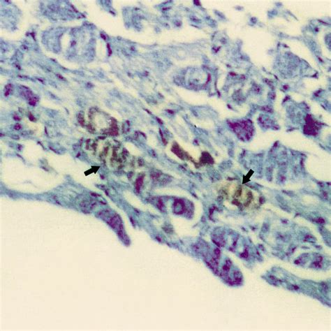 Avidin Biotin Complex Abc Staining Of Trigeminal Ganglia Of A Chicken
