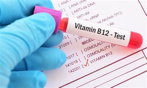 การตรวจวัดการดูดซึมของวิตามินบี 12 Schilling Test ของร่างกาย