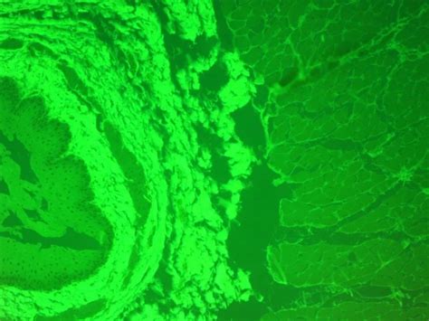 Nikon Eclipse E600 Upright Fluorescence Motorized Microscope New