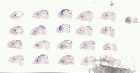 Otx2 Rna In Situ Gene Expression Assay Gxd
