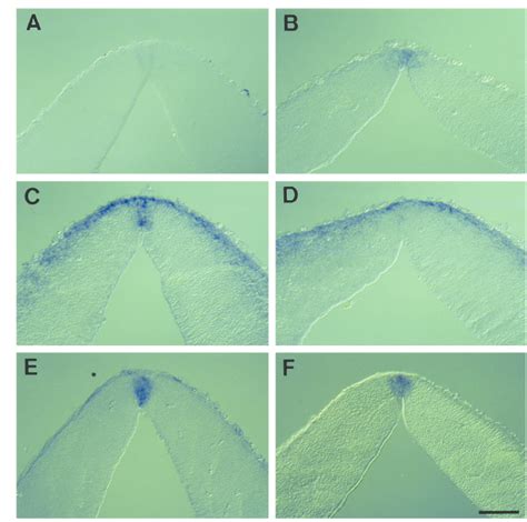 Expression Of E Cadherin αn Catenin And Wnt 1 Mrna In The Dorsal