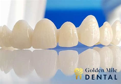 Getting A Crown After Root Canal Golden Mile Dental 16474906888