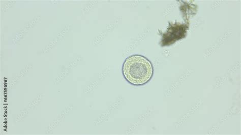 Larva Sea Urchin Strongylocentrotus Pallidus Under Microscope Phylum
