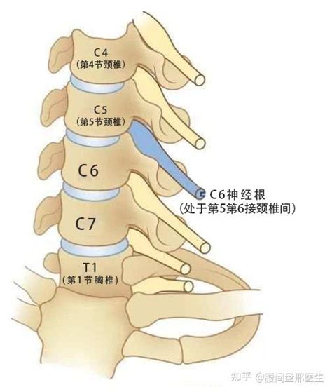 有种颈椎病的痛，打喷嚏会痛，咳嗽会痛，从头痛到手指头！ 知乎