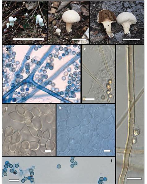 Figure 4 From Two New Lycoperdon Species Collected From