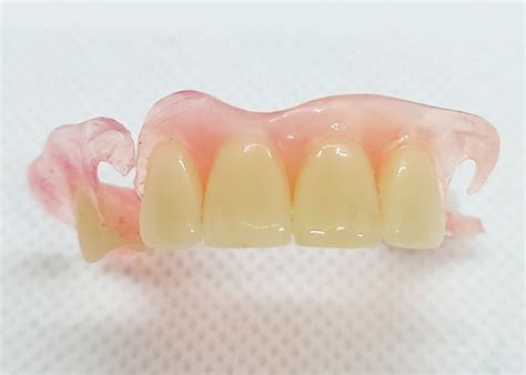 Flex Partial Denture