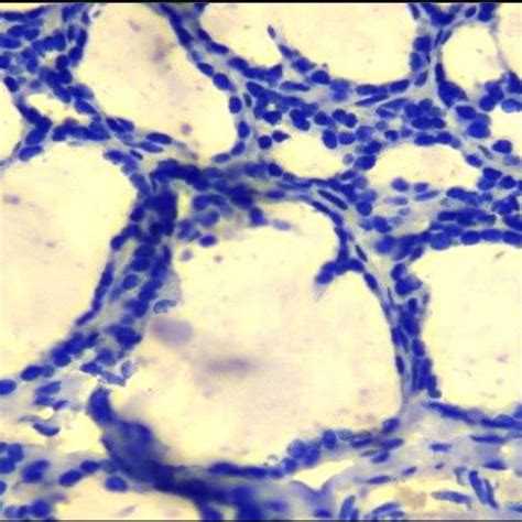 Thyroid Gland Section Showing Negative Control Staining For Il 6