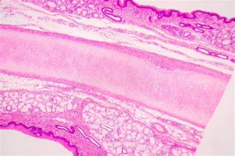 Histological Bone Elastic Cartilage Human And Joint Of Human Foetus