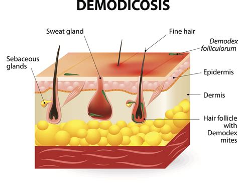 Effective Strategies To Eliminate Demodex Mites And Restore Healthy