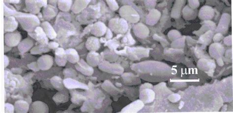 Sem Photographs Of Microbial Growth On Peat At Day 100 Download