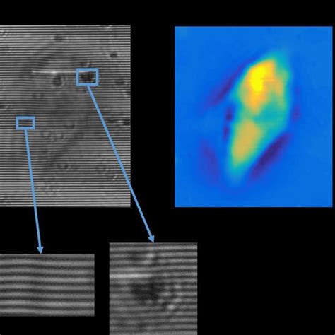 Diffraction Phase Microscopy Setup Download Scientific Diagram