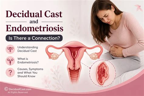Decidual Cast And Endometriosis Is There A Connection