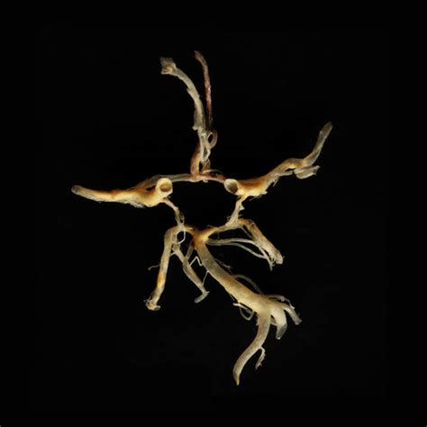 20 Circle Of Willis Fotografías De Stock Fotos E Imágenes Libres De