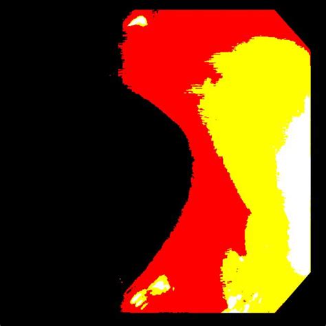 Cvc Colondb Object Detection Model V1 2024 04 03 1221am By Ntran