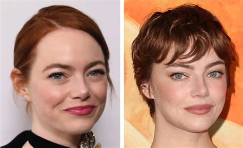 What Has Emma Stone Done To Her Face Lin