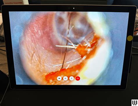 At Home Hearing Test Review Archyde
