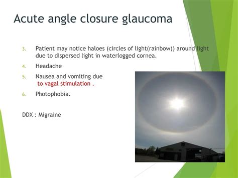 Ppt Glaucoma Powerpoint Presentation Free Download Id 9326370