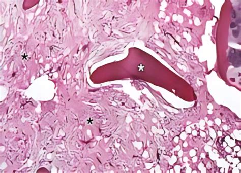 Antineoplastic Best Herbal Extracts