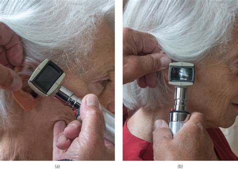 Examination Of The Ear Nose And Throat Ento Key