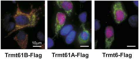 Trmt61b Is A Methyltransferase Responsible For 1 Methyladenosine At Position 58 Of Human