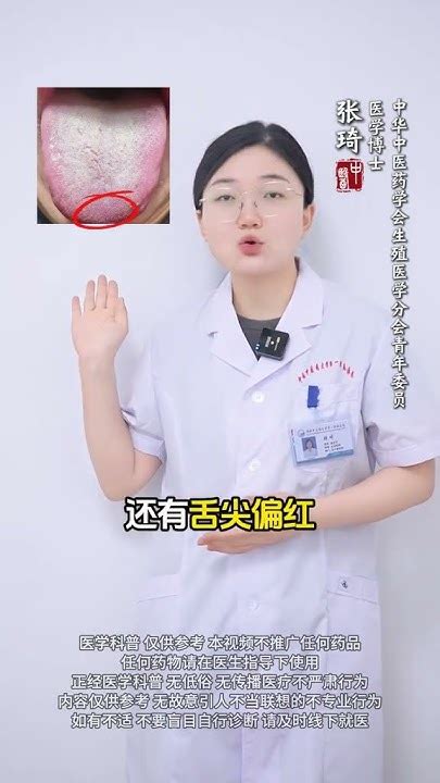 阳虚、肝郁、脾虚同时出现，疏肝是关键疏肝解郁 舌诊 中医健康 Youtube