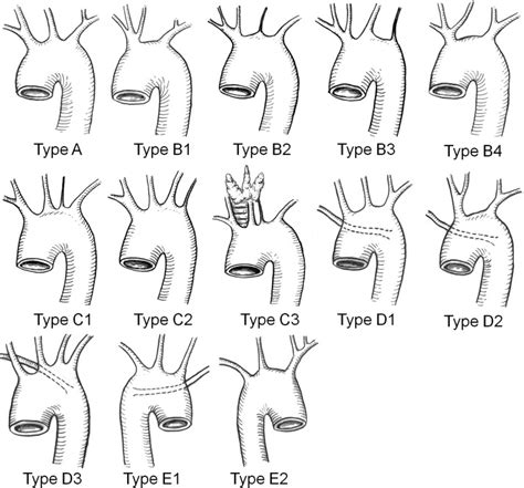Morphologic Features Of The Aortic Arch And Its Branches In The Adult
