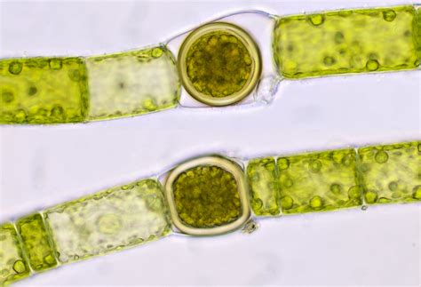 Filamentous Green Algae Microscopy Of Nature