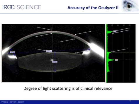 Utilizing Topolyzer Vario And Oculyzer Ii For Accurate Refractive Outcomes Pptx