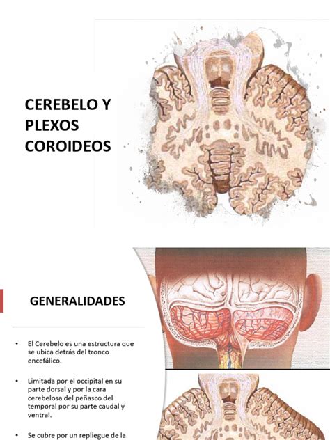 2 Cerebelo Plexos Coroideos 2024 Pdf Cerebelo Fluido