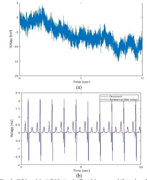 Figure 5 From Deep Learning Models For Denoising Ecg Signals Semantic Scholar