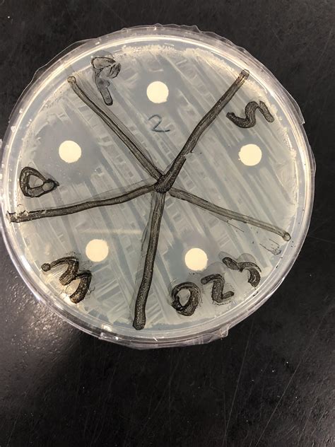 So Happy That My Highschool Microbiology Experiment Was Successful