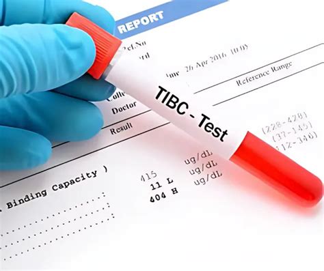 Total Iron Binding Capacity Tibc Blood Test Medi Linx Laboratory